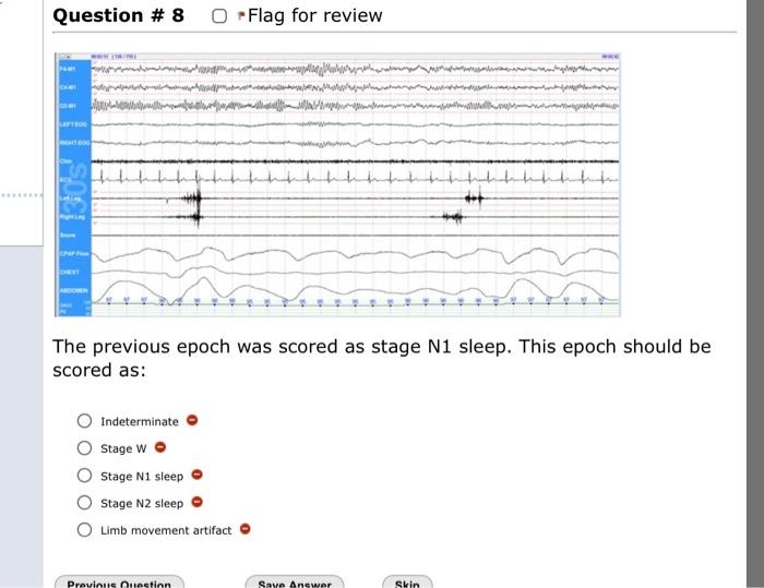 Solved 2 10 PE The previous epoch was scored as stage N1 | Chegg.com