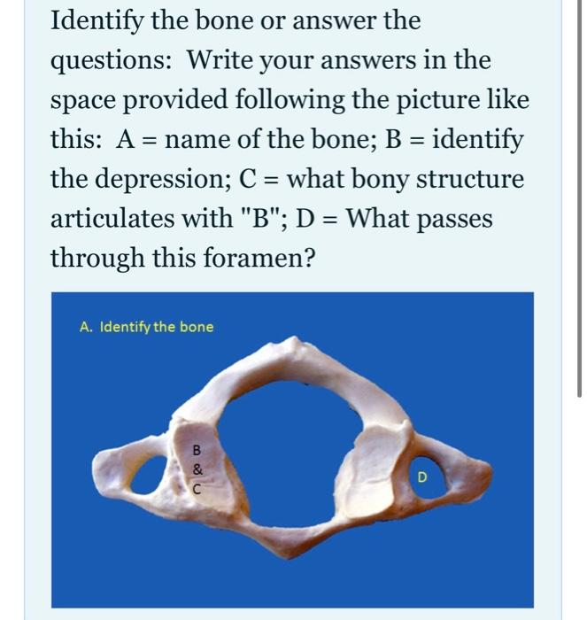 Solved Identify the bone or bony landmarks: Write your | Chegg.com