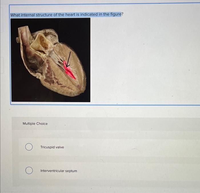 Solved What internal structure of the heart is indicated in | Chegg.com