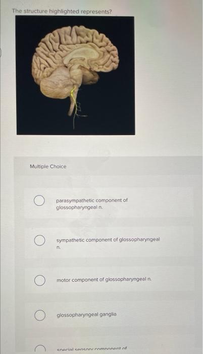 Solved The structure highlighted represents? Multiple Choice | Chegg.com