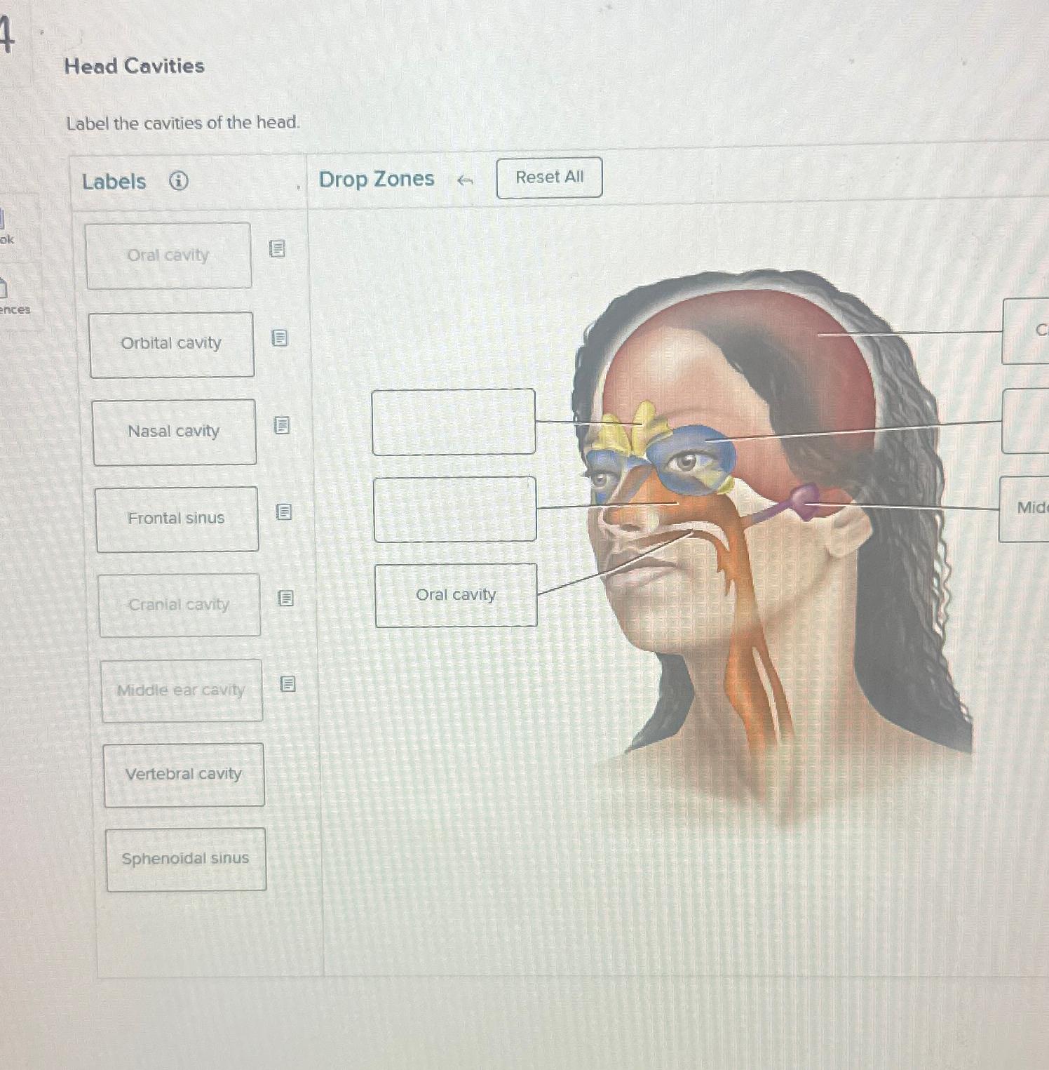 Solved Head CavitiesLabel the cavities of the | Chegg.com