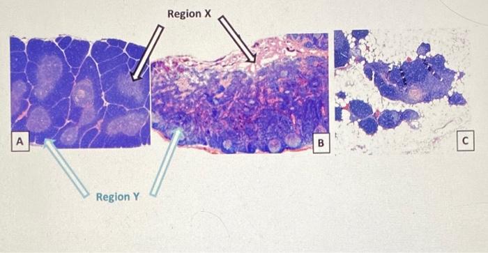 Solved 2. Learning objective: Compare histology of lymph | Chegg.com