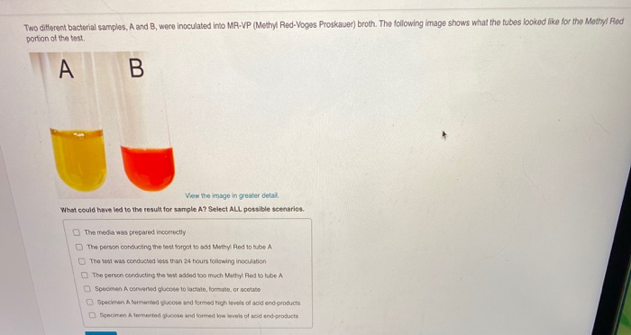 Solved Two different bacterial samples, A and B, were | Chegg.com