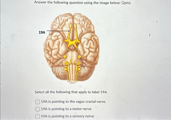 Solved Select all the following that apply to label 19A. ( | Chegg.com