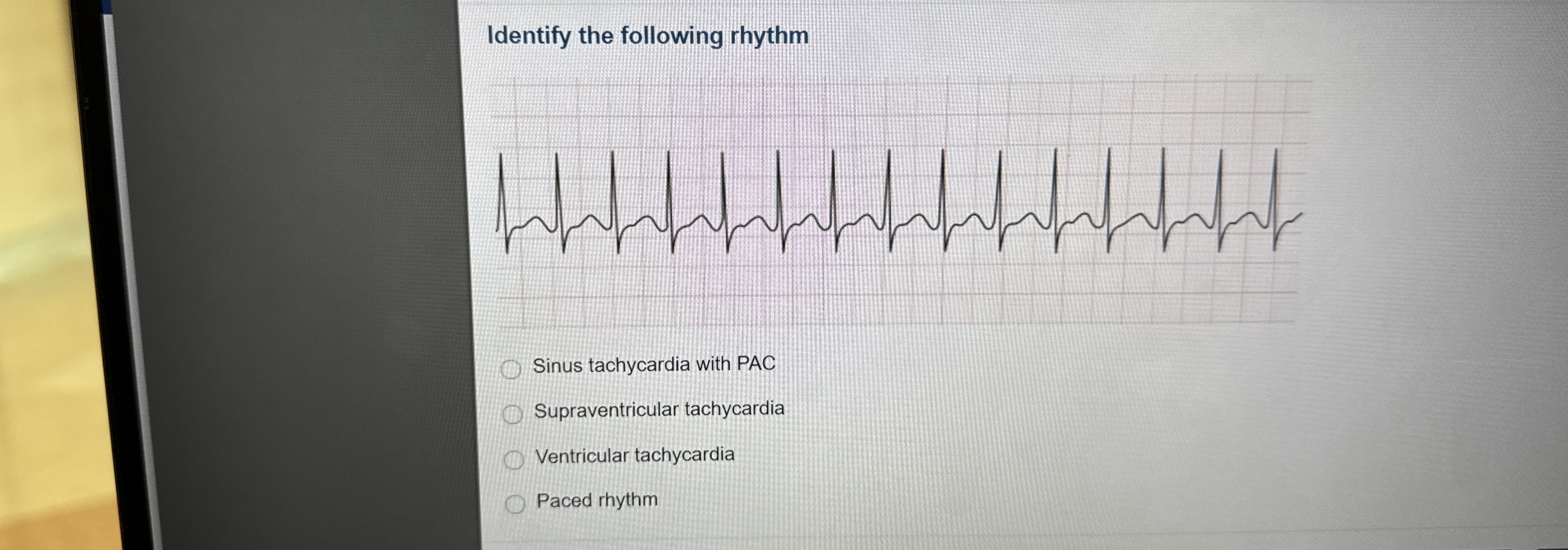 Solved Identify the following rhythmSinus tachycardia with | Chegg.com