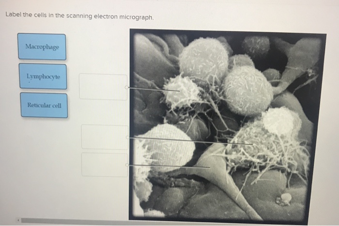 Solved Label the cells in the scanning electron micrograph. | Chegg.com