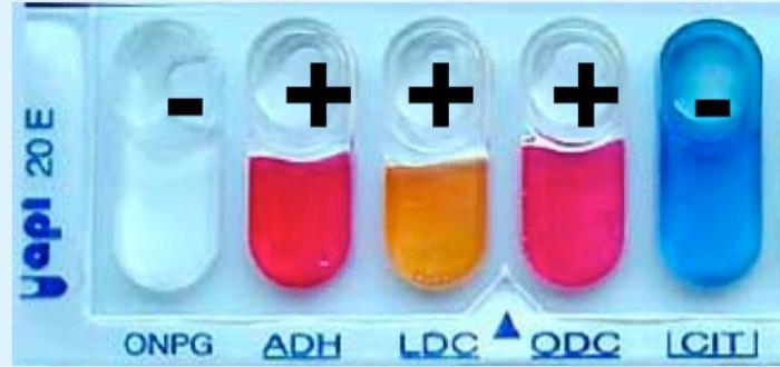 Solved What is the value assigned to the ONPG tube according | Chegg.com
