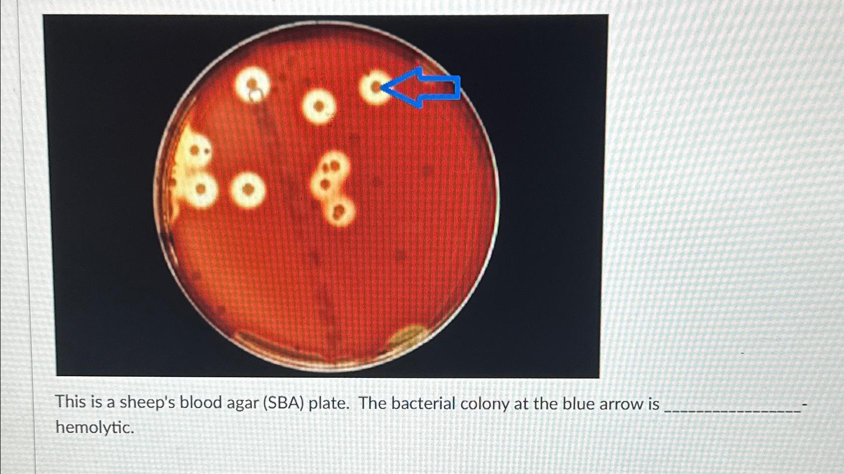 Solved This is a sheep's blood agar (SBA) ﻿plate. The | Chegg.com