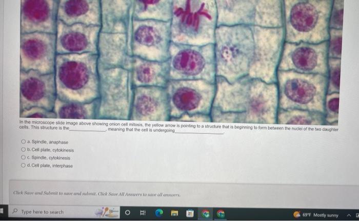 Solved In the microscope side imane above stiowing onion | Chegg.com