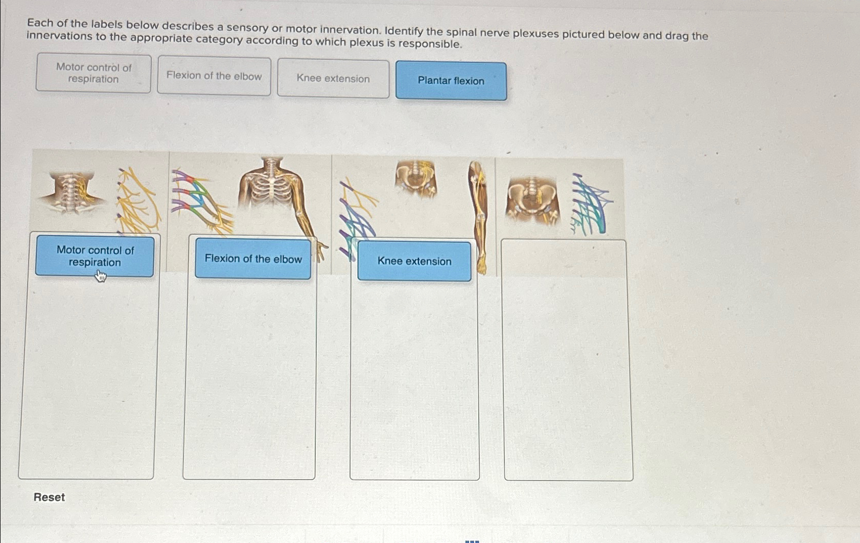 Solved Each of the labels below describes a sensory or motor | Chegg.com