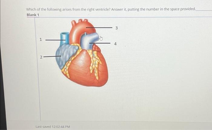 Solved Which of the following arises from the right | Chegg.com