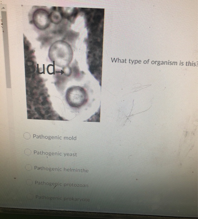Solved What type of organism is this? Pathogenic mold | Chegg.com