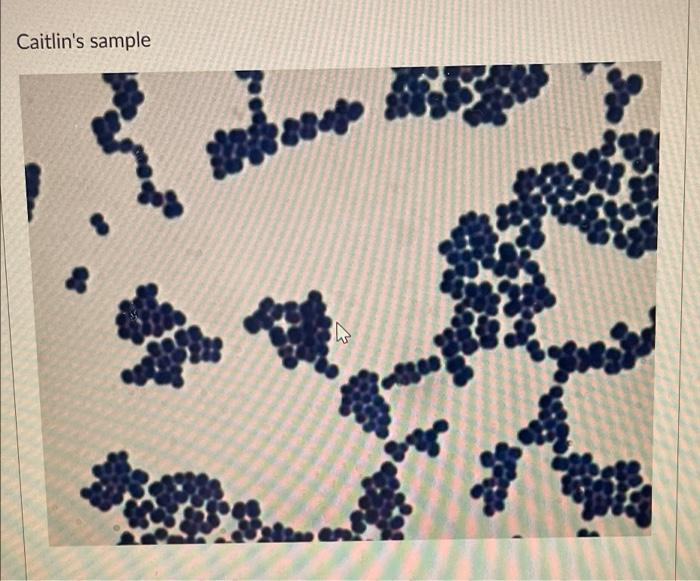 Solved llin attacks cross-links between strands of | Chegg.com