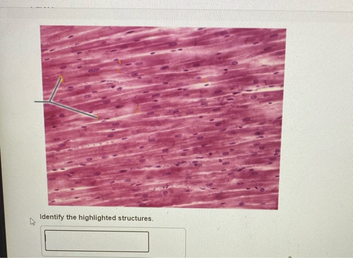 Solved Part A Identify the highlighted structure. perimesium | Chegg.com
