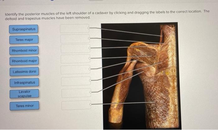 Solved Identify the posterior muscles of the left shoulder | Chegg.com