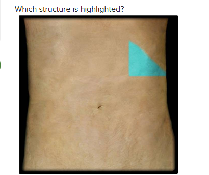 Solved Which structure is highlighted in blue?epigastric | Chegg.com