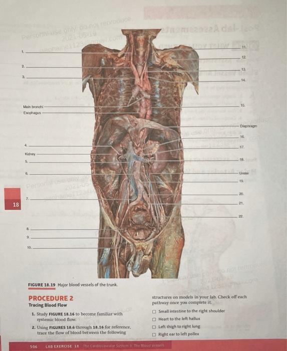 Solved 18FIGURE 18.19 ﻿Major blood vessels of the | Chegg.com