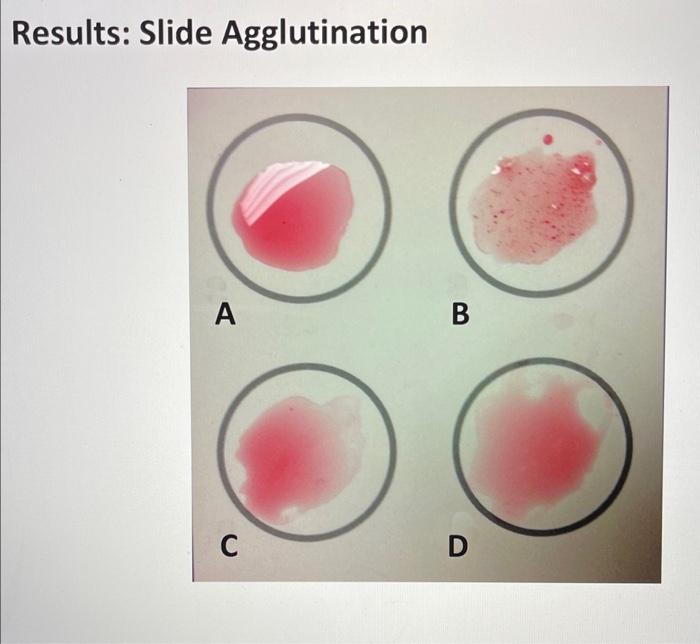 Solved Results: Slide AgglutinationResults: MSA | Chegg.com