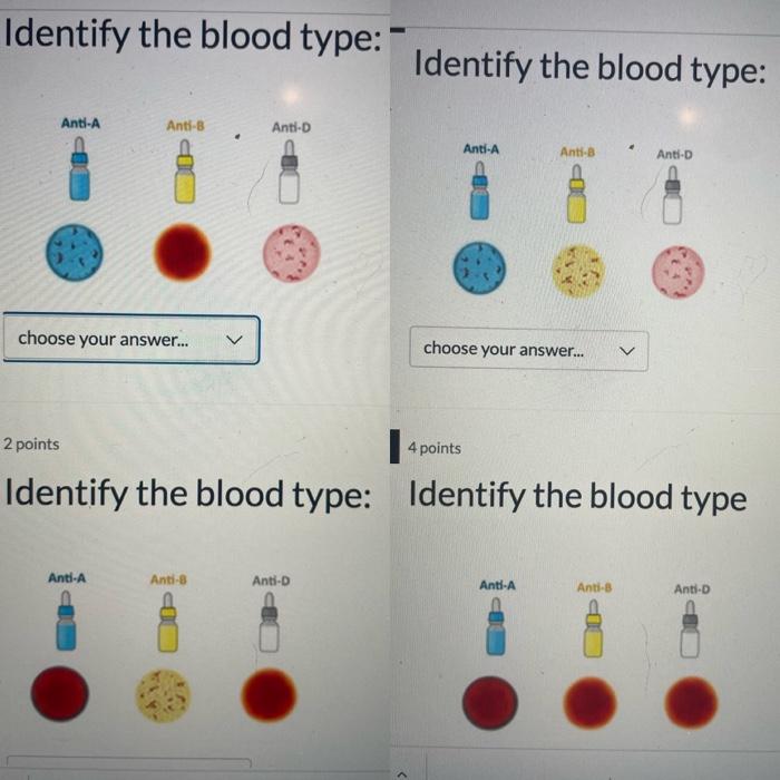 Solved Identify the blood type: −Identify the blood type: 2 | Chegg.com