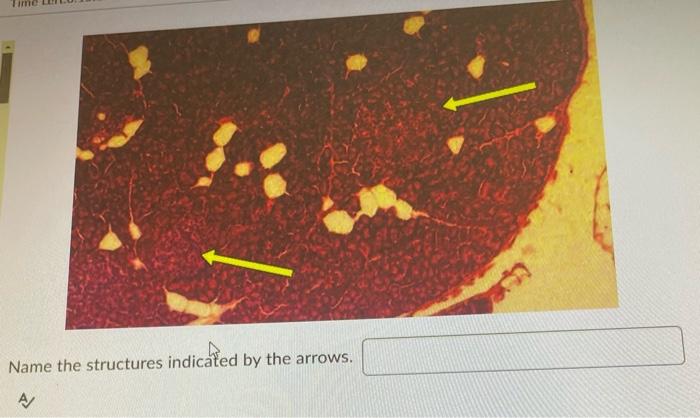 Solved Name the structures indicated by the arrows. A | Chegg.com