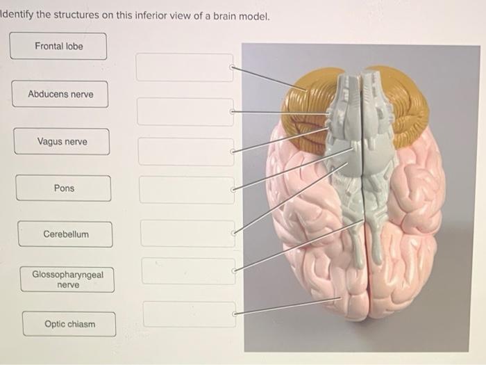Solved Identify the structures on this inferior view of a | Chegg.com