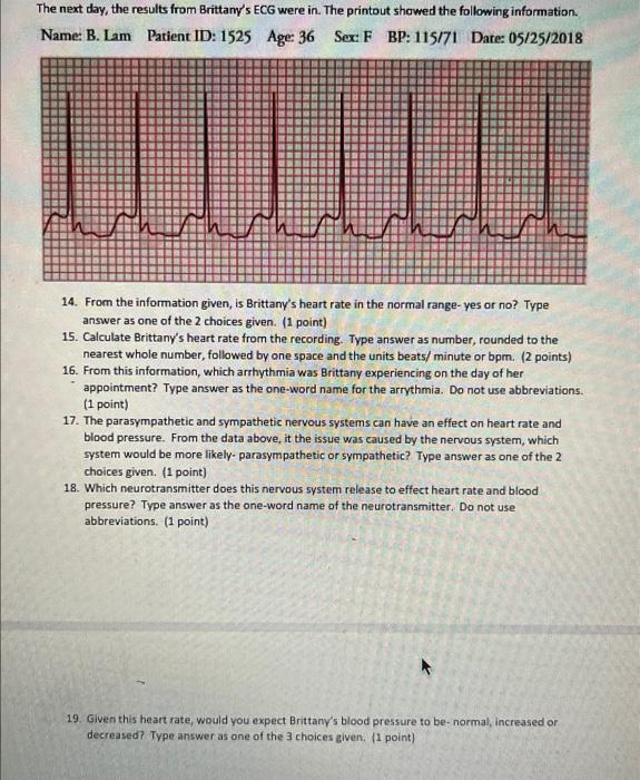 Solved As they studied a normal ECG recording, Ling asked | Chegg.com