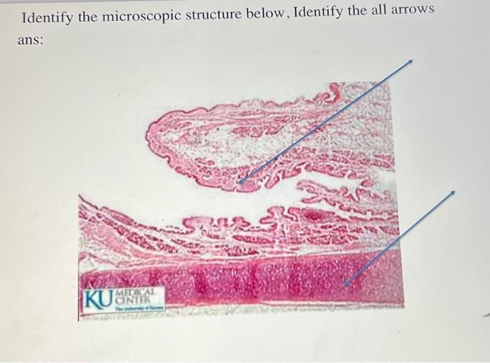 Identify the microscopic structure below, Identify | Chegg.com
