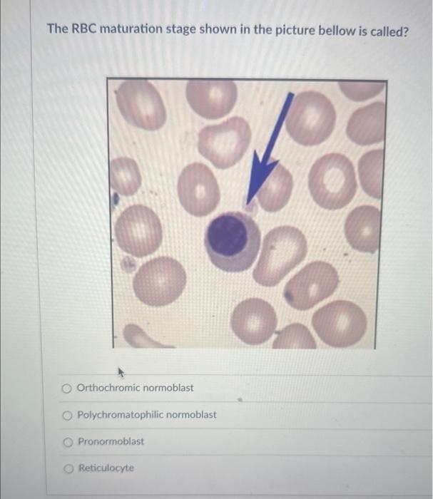 Solved The RBC maturation stage shown in the picture bellow | Chegg.com
