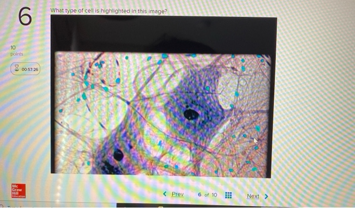 Solved What type of cell is highlighted in this image? 6 10 | Chegg.com
