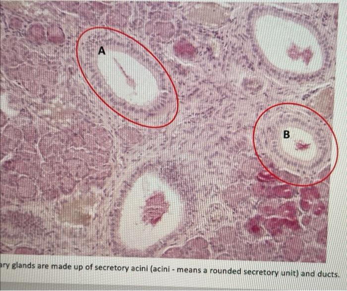 Solved A B ery glands are made up of secretory acini (acini | Chegg.com