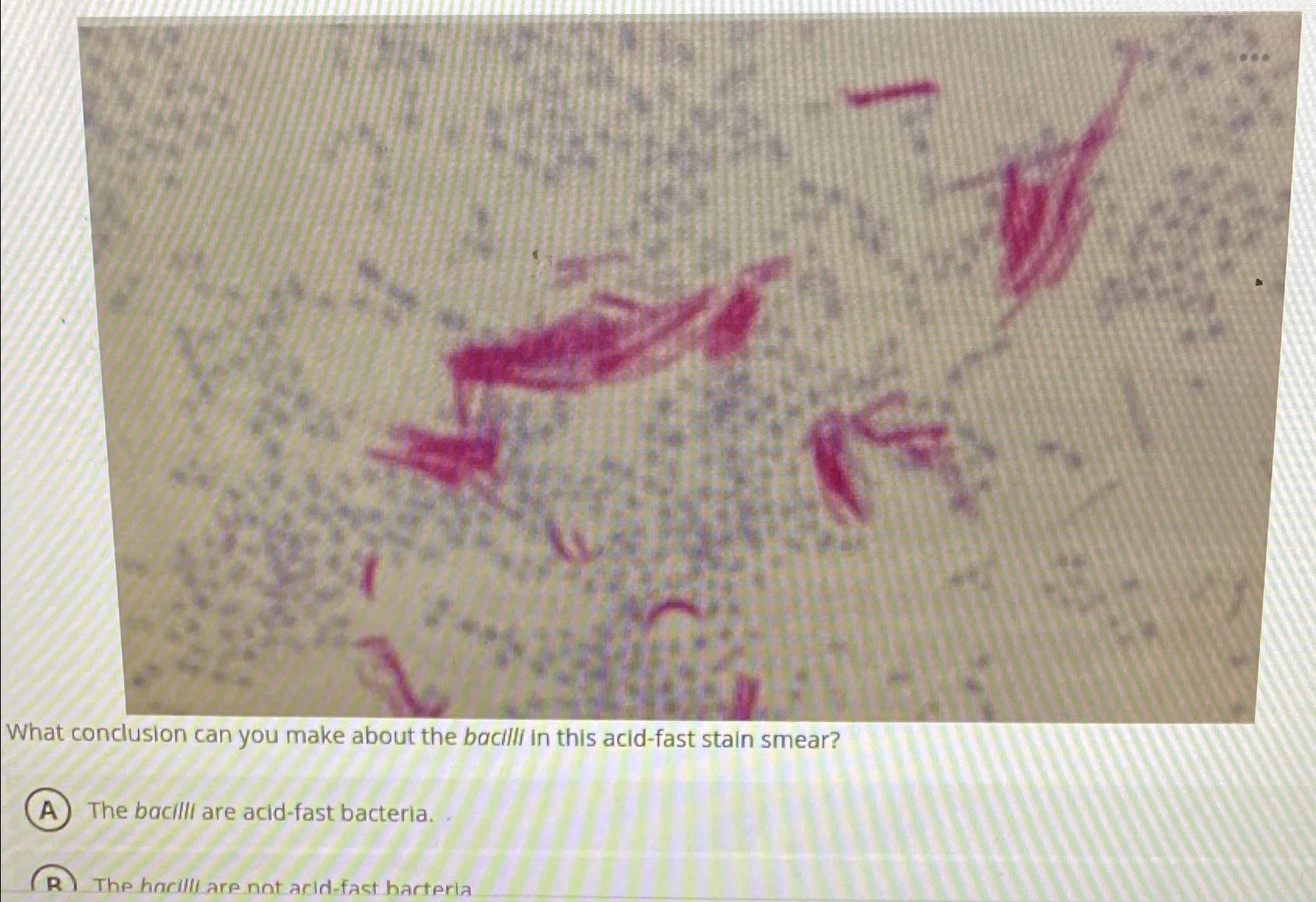 Solved What conclusion can you make about the bacilii in | Chegg.com