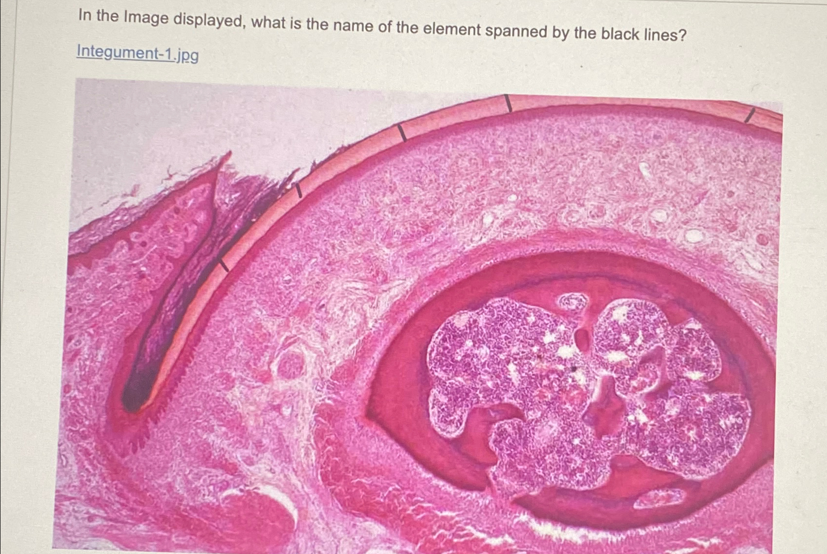 Solved In the Image displayed, what is the name of the | Chegg.com
