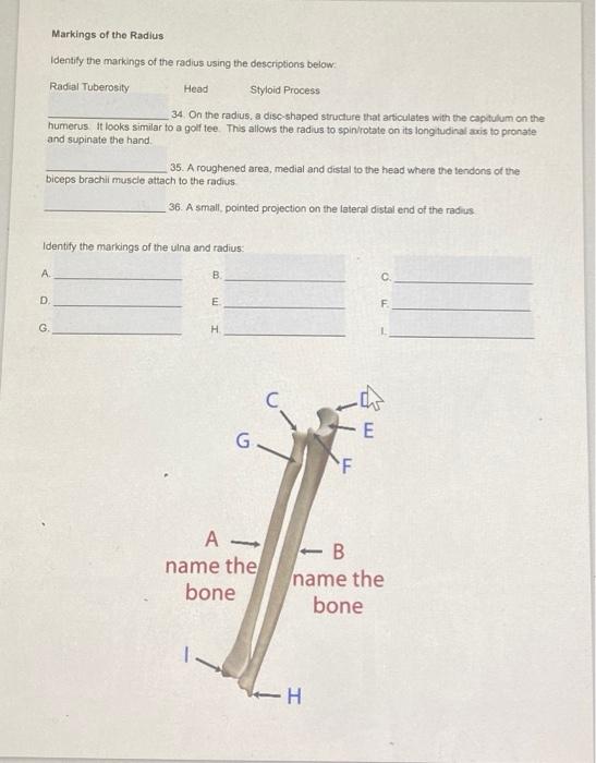 Solved 28. On the ulna, forms the "tip" or "point" of your | Chegg.com