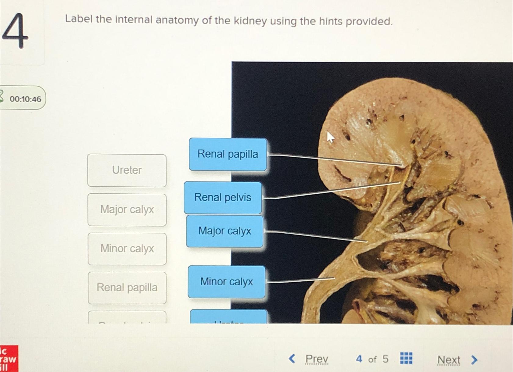 Solved 4Label the internal anatomy of the kidney using the | Chegg.com