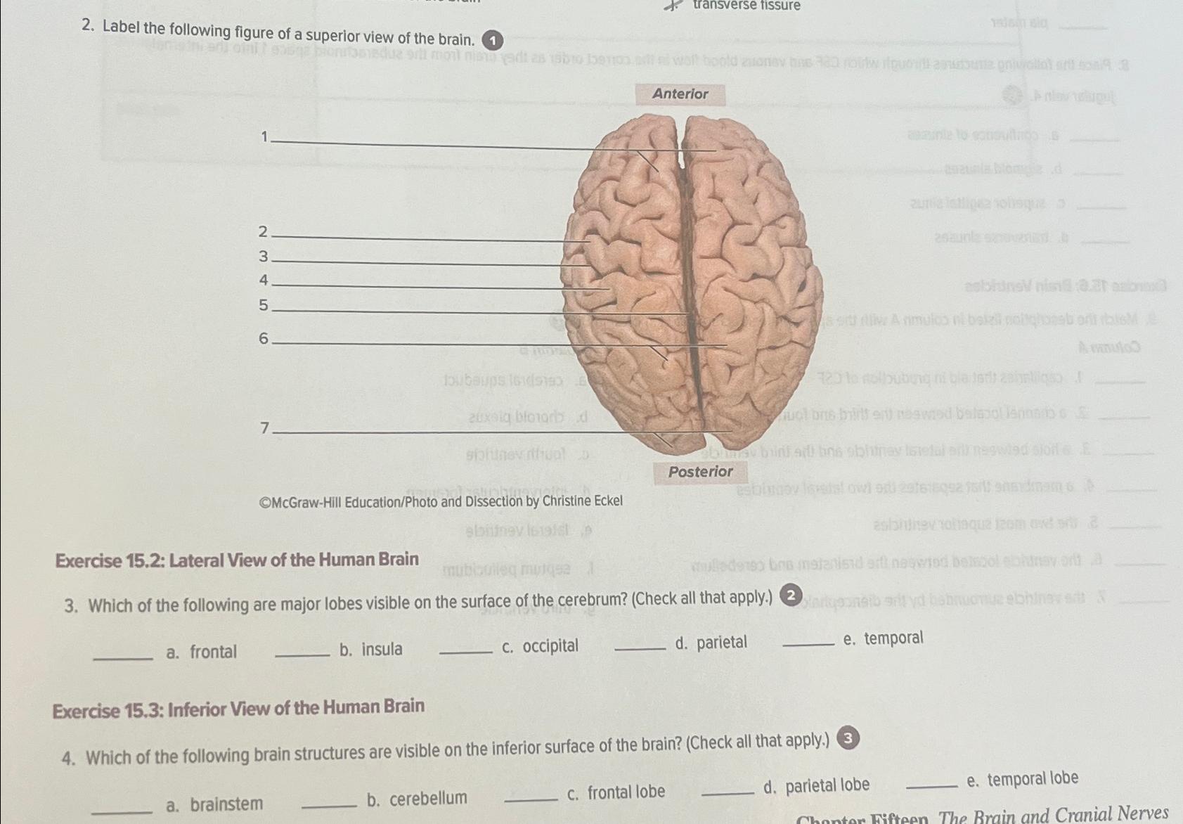 Solved Label the following figure of a superior view of the | Chegg.com