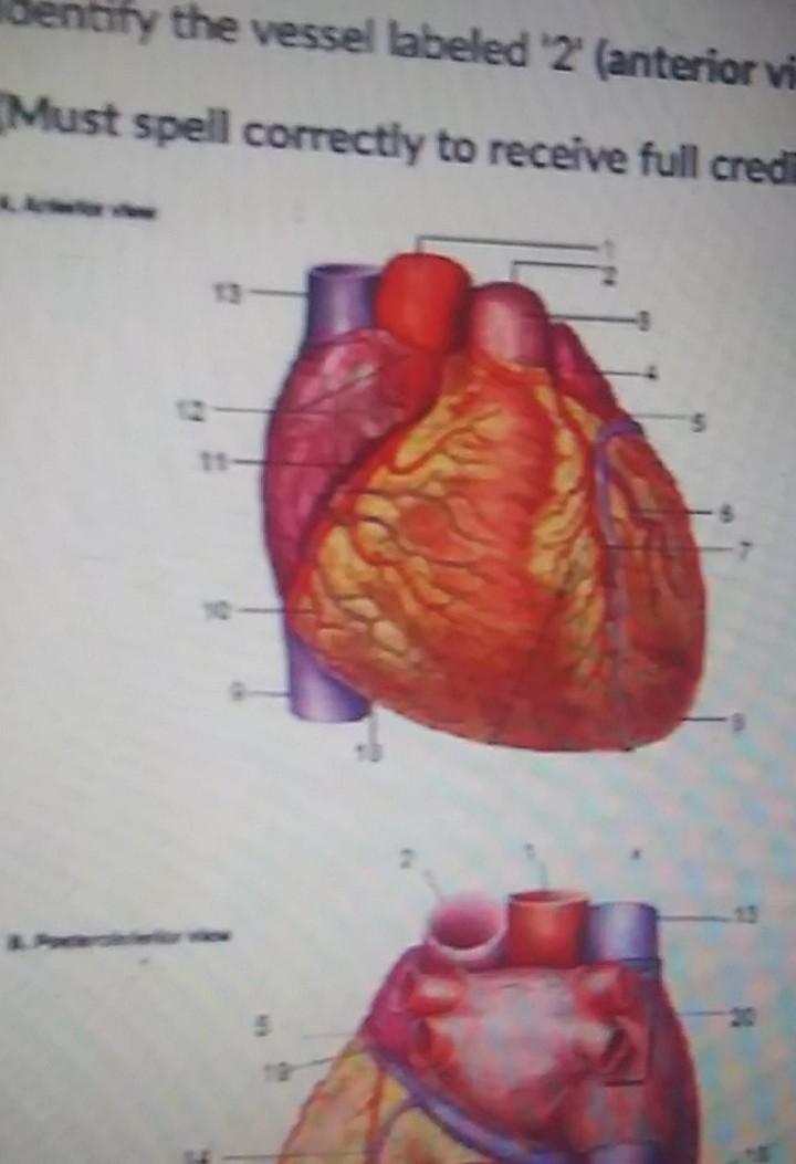 Solved Dentify the vessel labeled 2 (anterior vi Must spell | Chegg.com