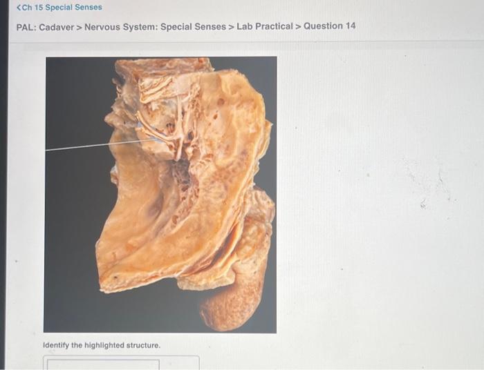 Solved Pal Cadaver Nervous System Special Senses Lab