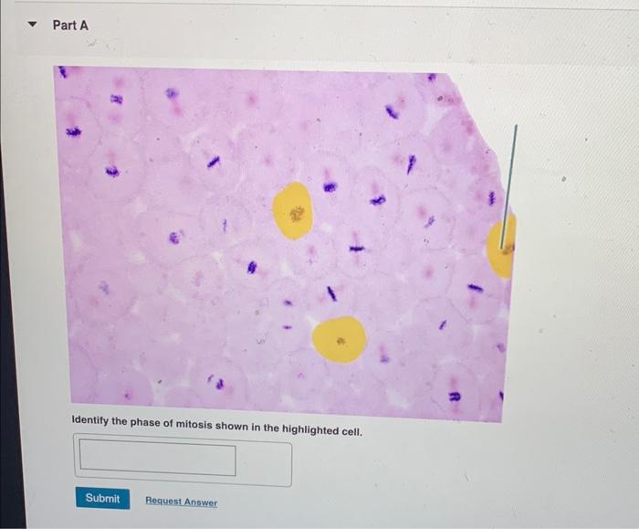 Solved Identify the phase of mitosis shown in the | Chegg.com