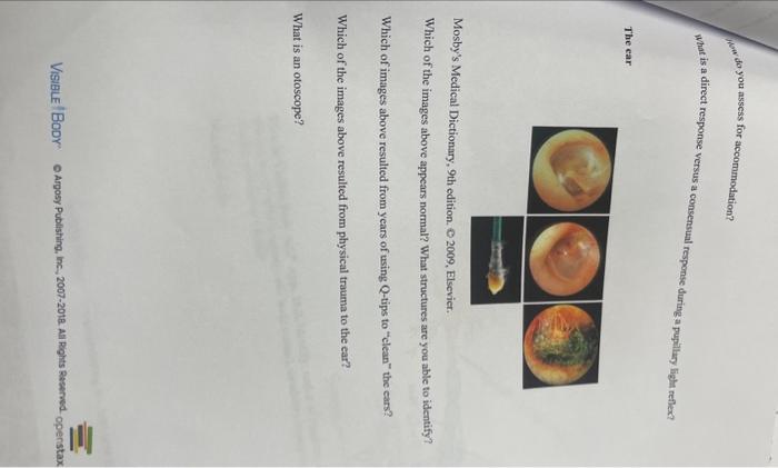 Solved What is a direct response versus a consensual | Chegg.com