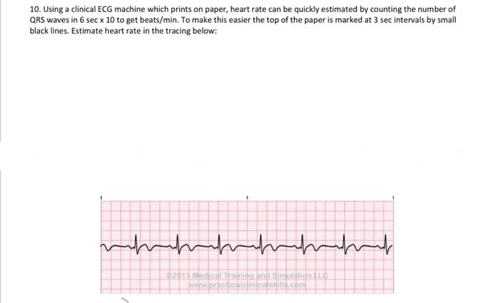 10. Using a clinical ECG machine which prints on | Chegg.com