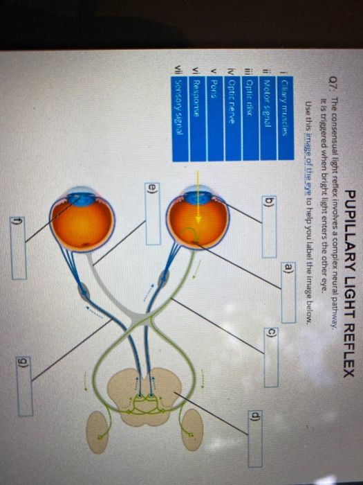 Pupillary Reflex Diagram