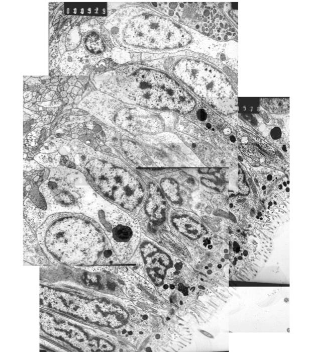label the TEM image below as many as you can label | Chegg.com