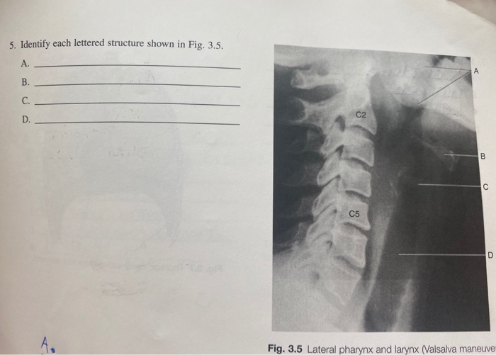 Solved 5. Identify each lettered structure shown in Fig. | Chegg.com