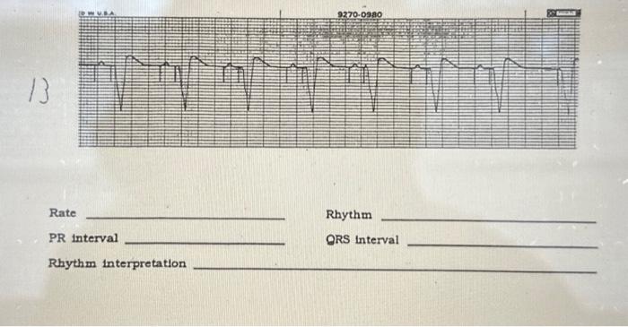 Rate Rhythm PR interval QRS Interval Rhythm | Chegg.com