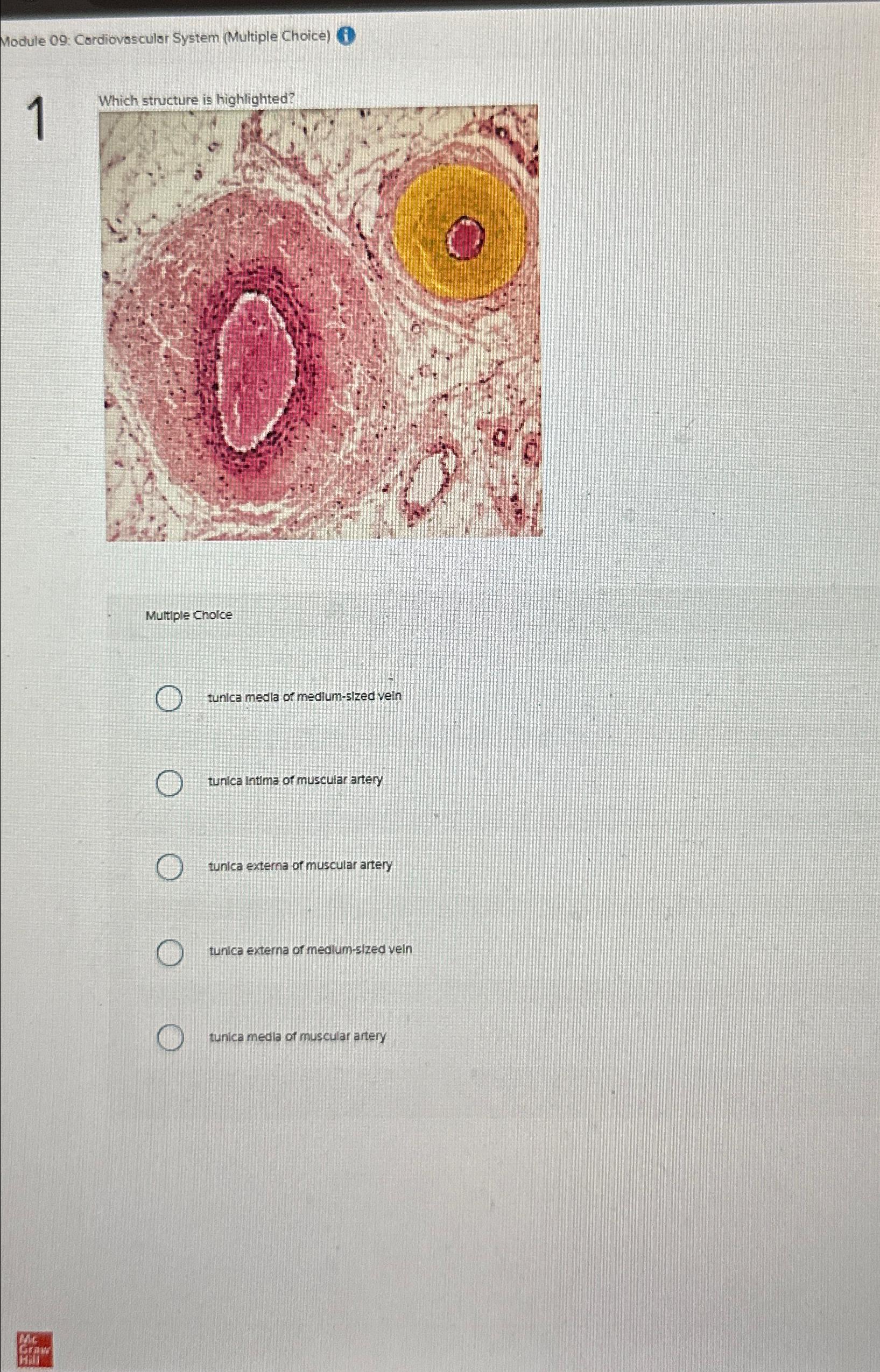 Solved Module 09: Cardiovascular System (Multiple Choice) 01 | Chegg.com