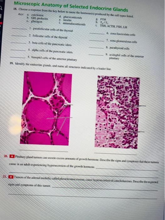 Solved Microscopic Anatomy of Selected Endocrine Glands 18. | Chegg.com