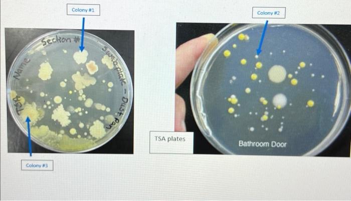 38 Case Study Exercise 6 Ubiquity of Microorganisms | Chegg.com