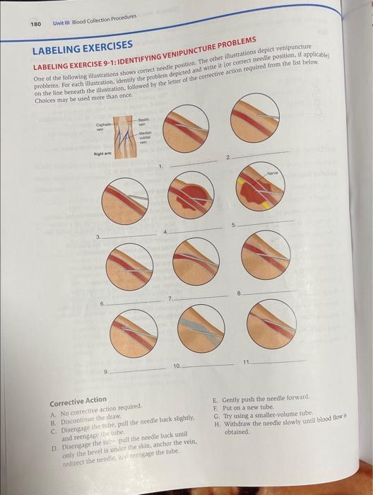 Solved LABELING EXERCISE 9-1: IDENTIFYING | Chegg.com