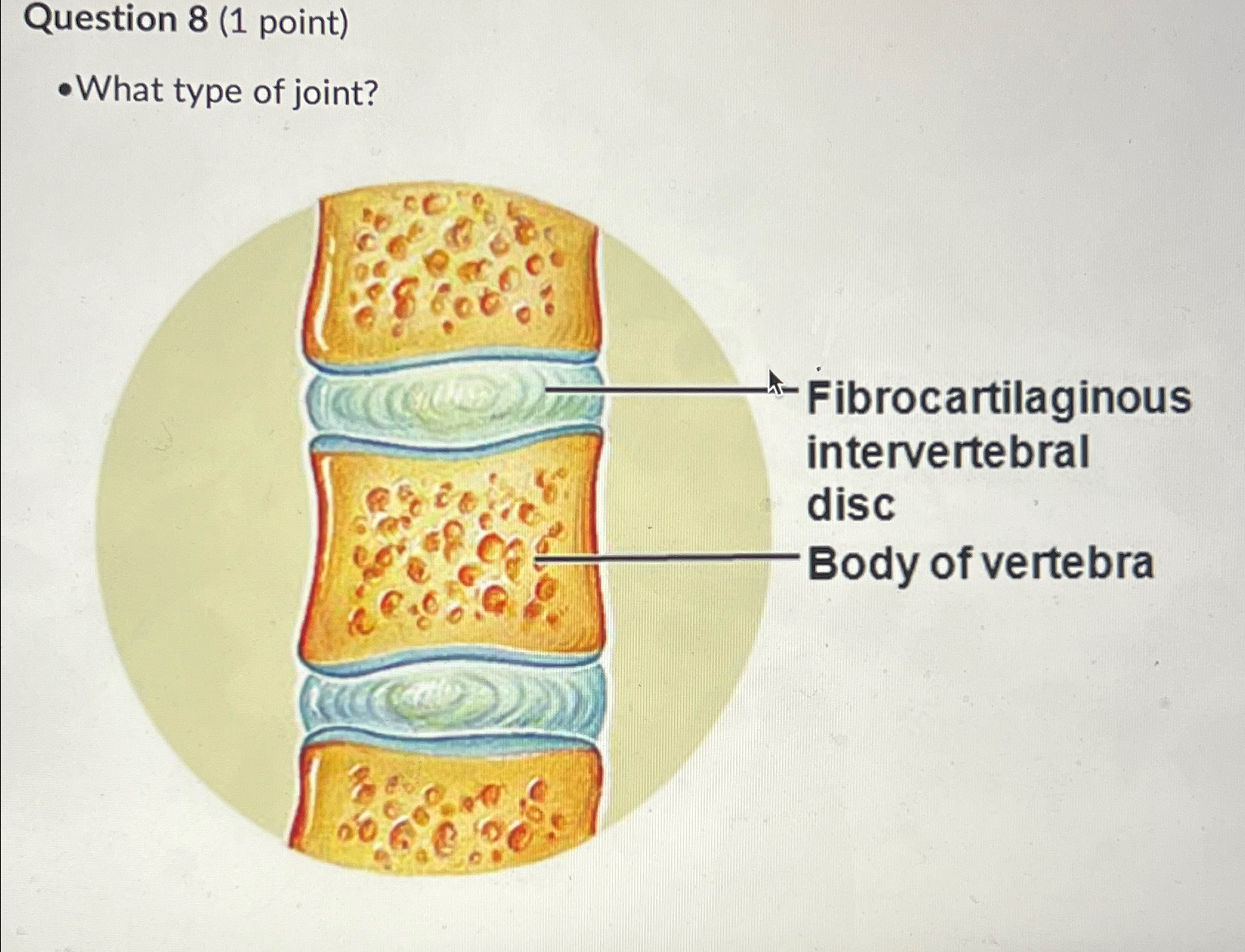 Solved Question 8 (1 point)-What type of joint? | Chegg.com Solved Question 8 (1 point)-What type of joint? | Chegg.com