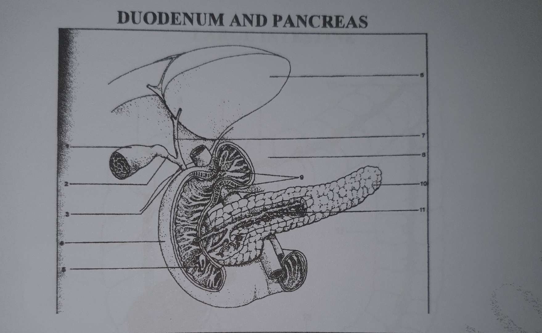 Solved DUODENUM AND PANCREAS. pls label (anatomy and | Chegg.com